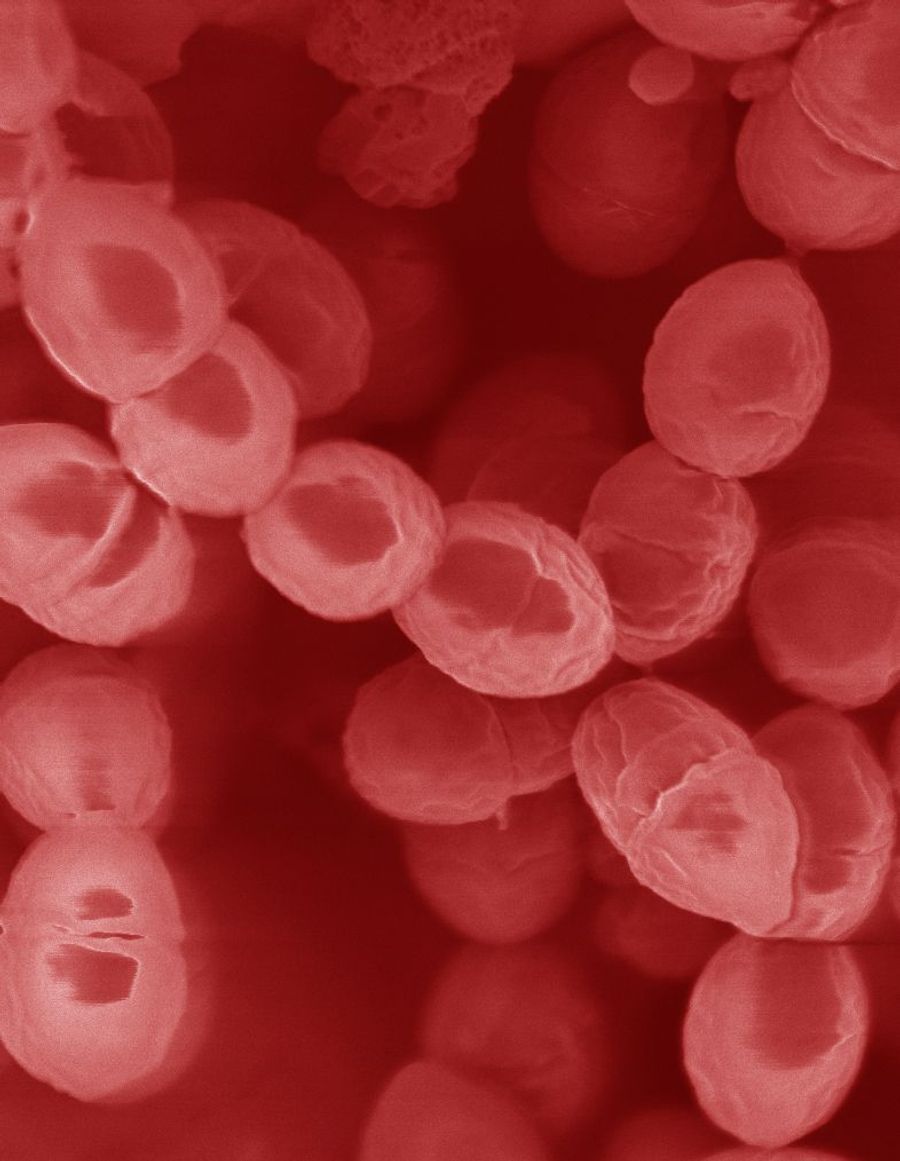 The Therapeutic Potential of Bioengineered Bacteria | Today's Clinical Lab