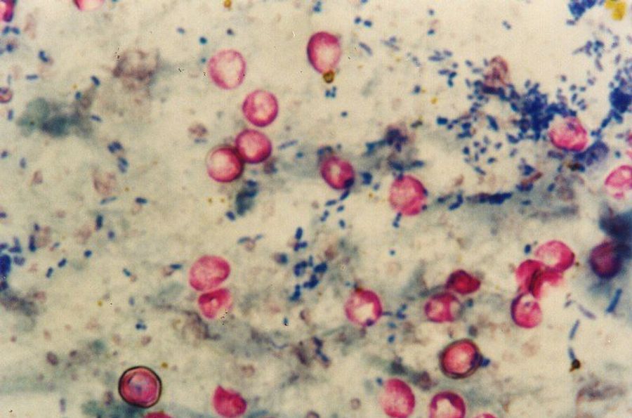 Diagnostic Tool for Detecting Cryptosporidium | Today's Clinical Lab