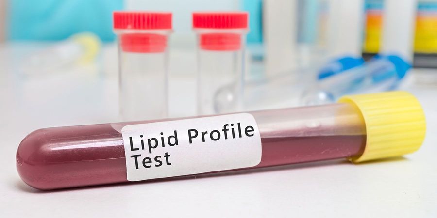 Blood Lipid Profile Predicts Risk of Type 2 Diabetes Better Than ...