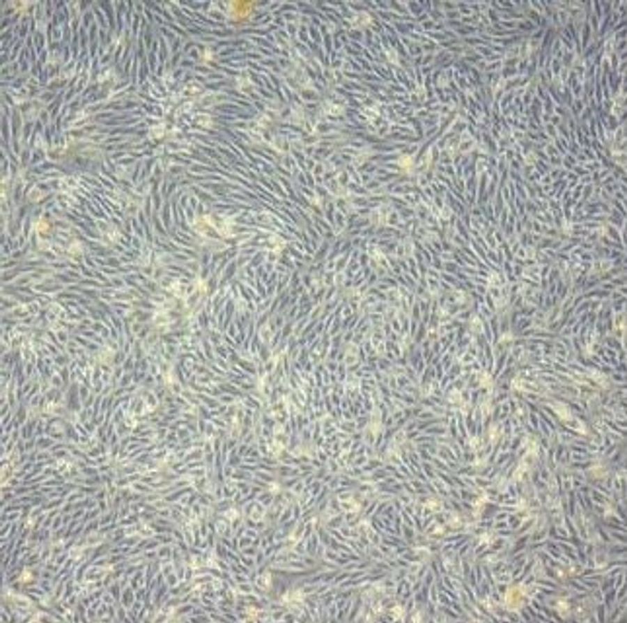 Kidney Stem Cells Can Be Isolated from Urine | Today's Clinical Lab