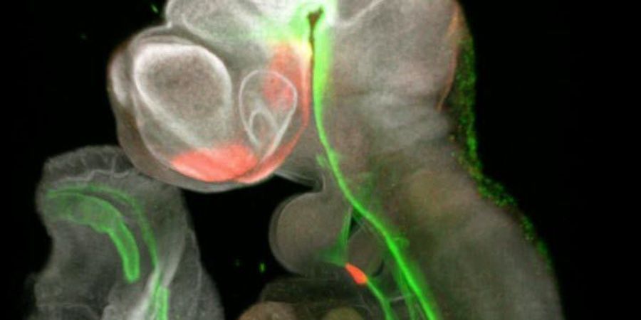 Two Discoveries Boost Next-Generation Organoid Development | Today's ...