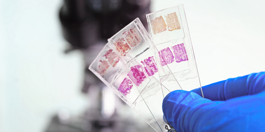 Spatial Transcriptomics Named Natures Method Of The Year 2020 Today