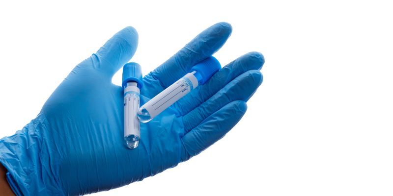 Sodium Citrate Blood Specimen Collection Tubes: Frequently Asked ...
