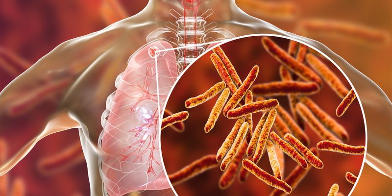 Rapid Communication on Updated Guidance for the Management of TB ...