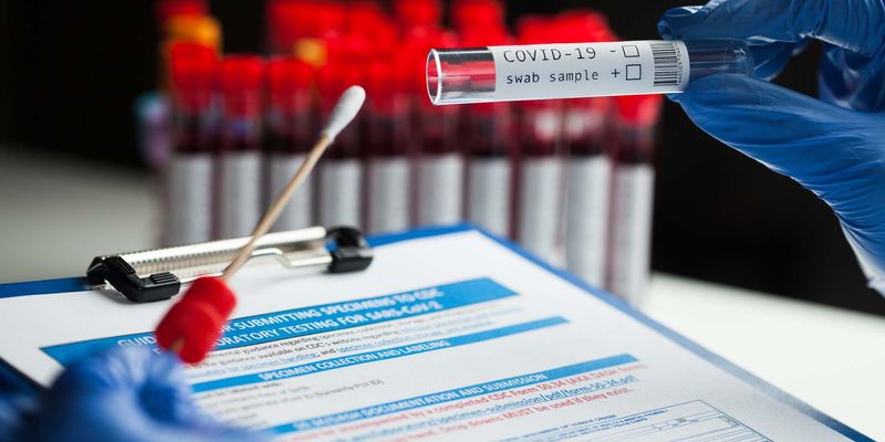 CDC Internal Investigation Probes First Batch of COVID-19 Tests | Today ...