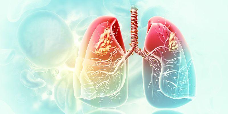 New Blood Test Can Help Doctors Diagnose Tuberculosis and Monitor ...