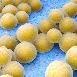 Multicenter Trial Supports Use of Topical Antibiotics in NICU Babies ...