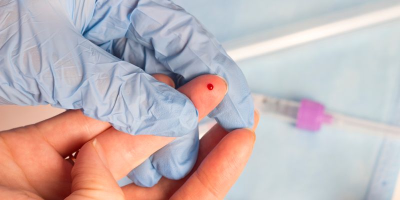 Novel POC, Finger-Prick Test for Trichomoniasis | Today's Clinical Lab