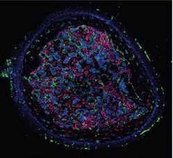Spatial Transcriptomics Named Nature’s Method of the Year 2020 | Today ...
